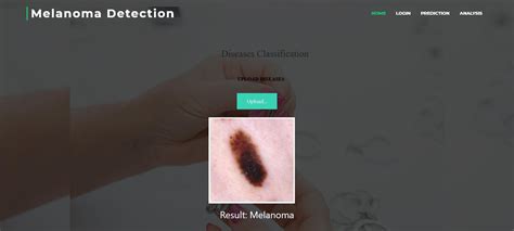 Skin Lesion Analysis Towards Melanoma Detection Using Deep Learning