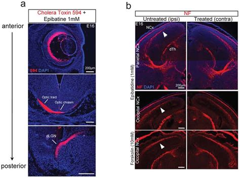 Timing And Connectivity Of Retino Thalamic And Thalamocortical Visual