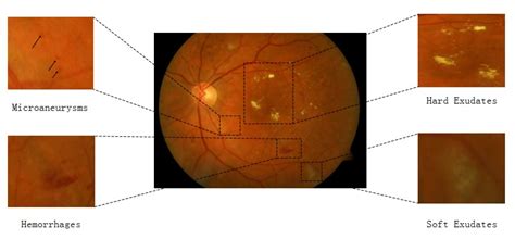 Biomimetics Free Full Text Data Diversity In Convolutional Neural Network Based Ensemble