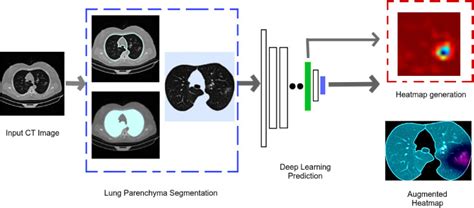 Detecting COVID From Chest Computed Tomography Scans Using AI Driven Android Application