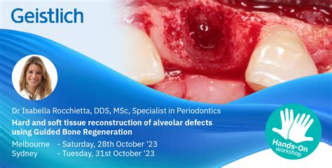 hard and soft tissue reconstruction of alveolar defects using guided