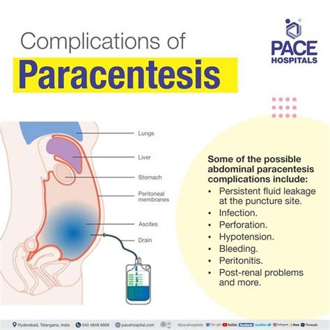 Paracentesis Fluid Interpreting Abdominal Fluid In Colic Horses