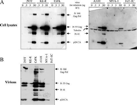 Reduced Hiv 1 Gag Expression In Feline T Cells And Restricted Hiv 1