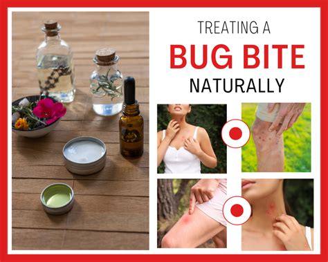 TREATING A BUG BITE NATURALLY AND EFFECTIVELY
