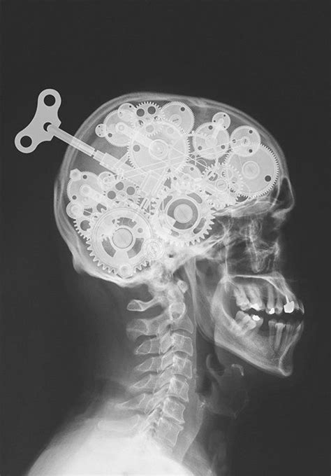 Cogs Ticking Skull X Ray Xray Art X Ray Human Anatomy Art