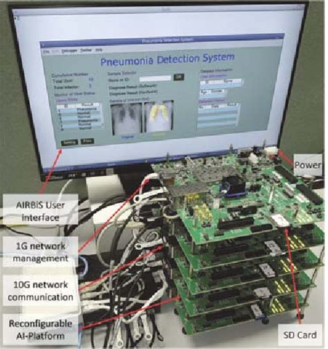 Figure 1 From Scaling Deep Learning Pneumonia Detection Inference On A