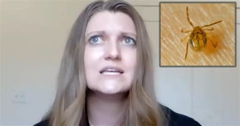 Woman Uncovers The Surprising Cause Of Her Sudden Red Meat Allergy A