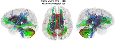 Tracks Where TPC CHD While Controlling For Sex This Contains Much Of Download Scientific