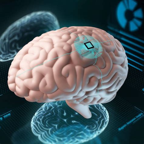 ¿qué Es Neuralink El Chip Neuronal Que Empezará A Probarse En Humanos Lleca Periodismo