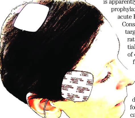 Right Unilateral Placement Download Scientific Diagram