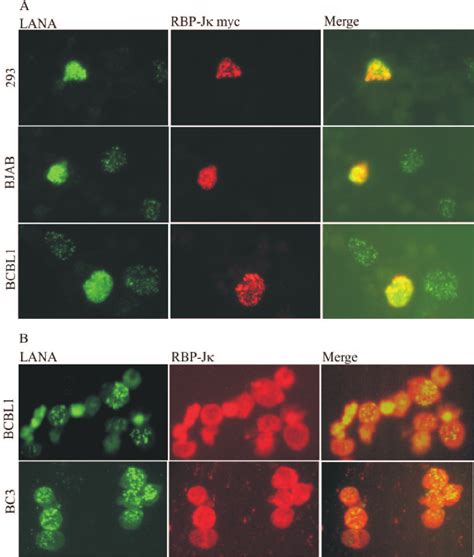 Immunofluorescence Analysis Showed That Rbp J ␬ Was Localized To The