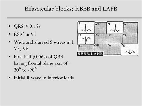 PPT Bundle Branch Blocks And Hemiblocks Take Home Points PowerPoint Presentation ID