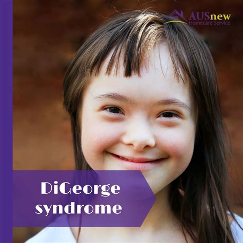 Digeorge Syndrome Artofit