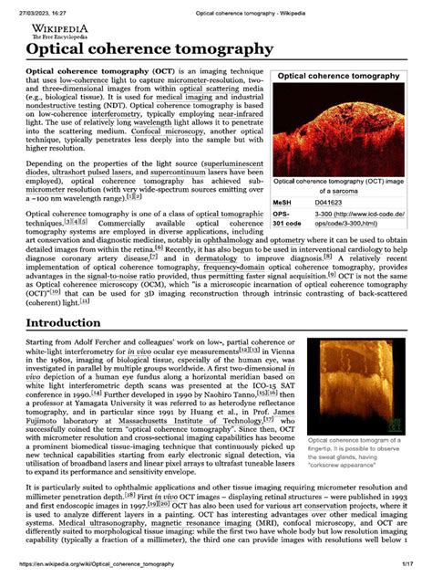Optical Coherence Tomography Wikipedia Pdf