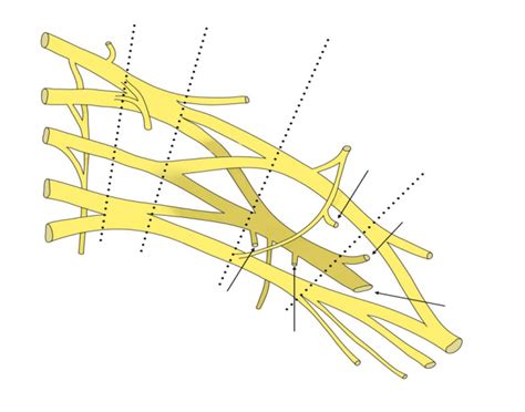 Brachial Plexus Labeling Quiz