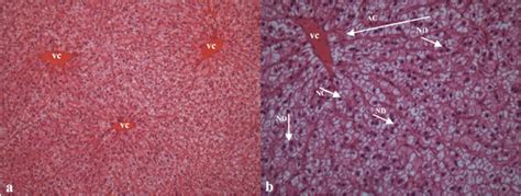 Liver Characteristics Of Pacu Juveniles Fed Diets Supplemented With Download Scientific Diagram