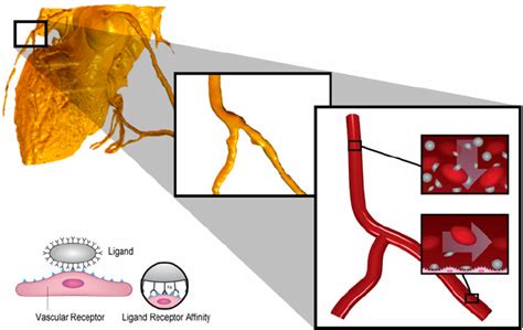 Reconstructing The Patient Specific Vascular Geometry Download Scientific Diagram