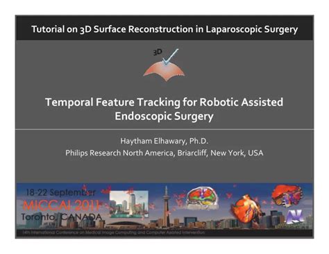 [ppt] Temporal Feature Tracking For Robotic Assisted Endoscopic Surgery Powerpoint