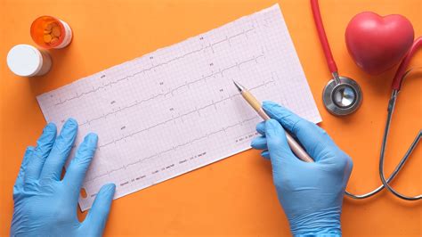 V Tach ECG Ventricular Fibrillation EKG VTach Vs VFib Explained