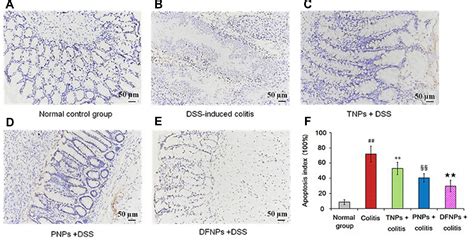 Figure 9 From Dual Functional Eudragit® S100 L30d 55 And Plga Colon Targeted Nanoparticles Of
