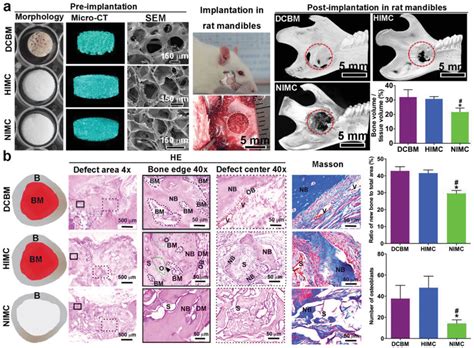 Normal Architecture Of Natural Bone With Bone Marrow Compartments Download Scientific Diagram