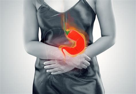 Reflujo Gastroesofágico Causas Y Tratamiento Zigomat