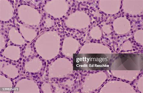 Thyroid Follicle
