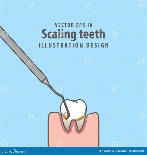 Layout Scaling Teeth Illustration Vector On Blue Background Den