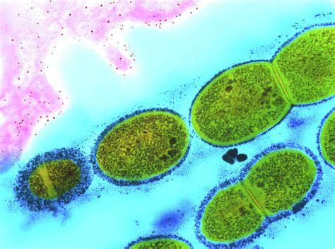 Streptococcus Pyogenes Bacteria On Tonsil Photograph By Dr Kari Lounatmaascience Photo Library
