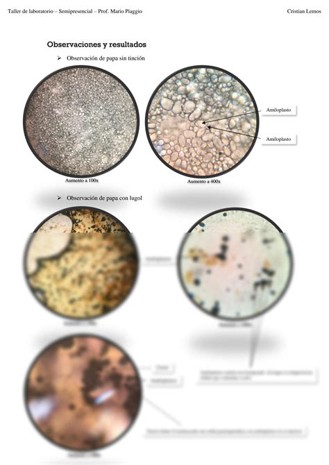 Solution Pr Ctica C Lula Vegetal Amiloplastos Studypool