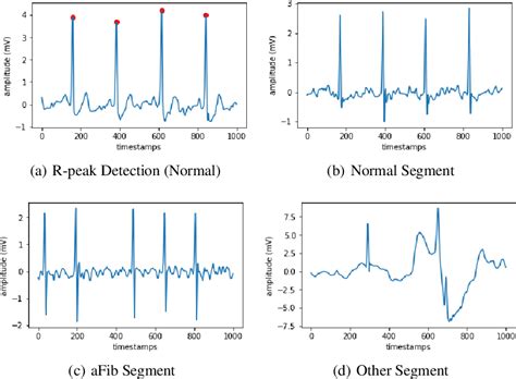 Figure 1 From Atrial Fibrillation Detection And Ecg Classification Based On Cnn Bilstm