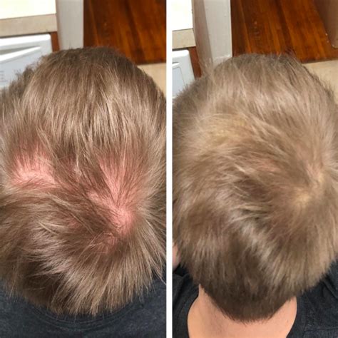 21 Things You Need If You Have Fine Flat Hair