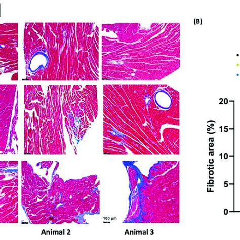 Myocardial Fibrosis At 660 Days Post Ir Transverse Sections Of Hearts