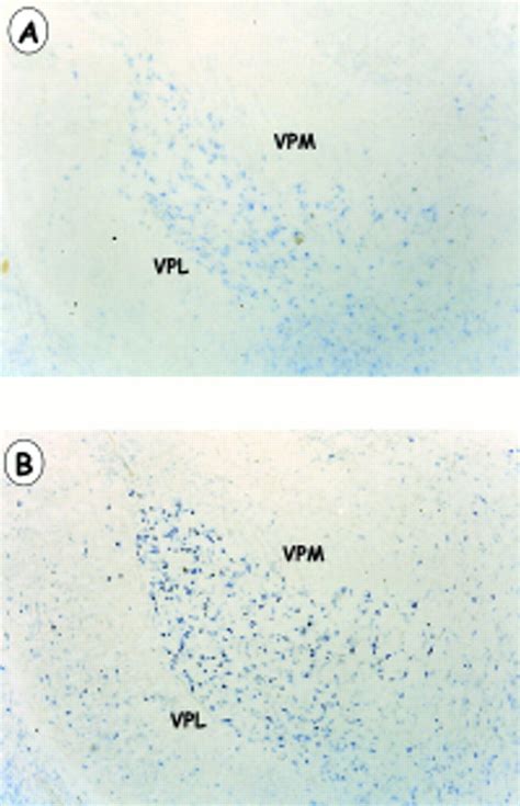 The Expression Of Ccn3 Nov Rna And Protein In The Rat Central Nervous System Is