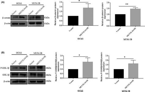 mettl14 promotes migration and invasion of choroidal melanoma by