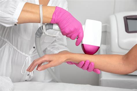 여성의 몸에 에로스 제모 제모 절차 미용실에서 레이저 회춘을 하는 미용사 페이셜 스킨 케어 하드웨어 Ipl 화장품 손에 대한 스톡 사진 및 기타 이미지 Istock