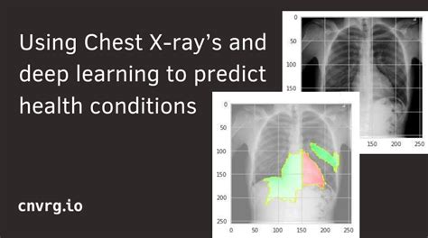 using chest x ray s and deep learning to predict health conditions