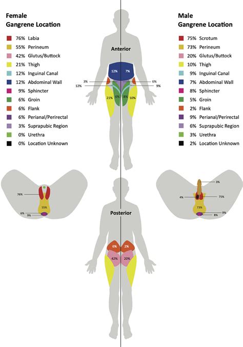 Fourniers Gangrene Guidelines Cgnpeb