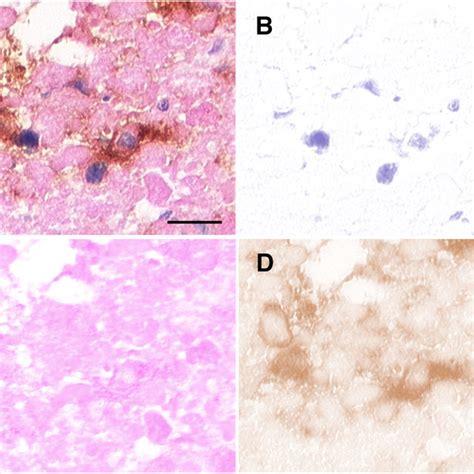 Pdf Quantification Of Histochemical Staining By Color Deconvolution