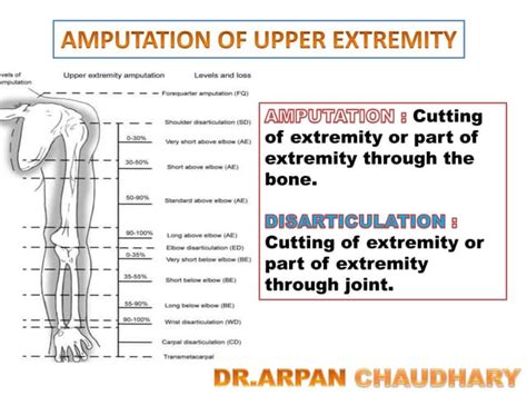 Upper Limb Amputation Except Hand By Dr Arpan Chaudhary Pptx