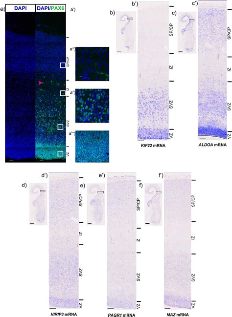 Figure 1 From Expression Of Genes In The 16p11 2 Locus During Development Of The Human Fetal