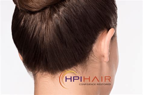 Topical Finasteride Buy Prescription Topical Finasteride And Minoxidil