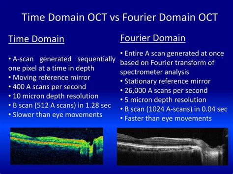 Ppt Fourier Domain Oct The Rtvue Powerpoint Presentation Free