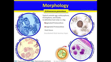 Echinococcus Granulosus And Echinococcus Multilocularis Cestodes Youtube