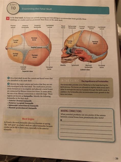 Solved Classifying Bones According To Location Bones Can Be Solved Classifying Bones According To Location Bones Can Be