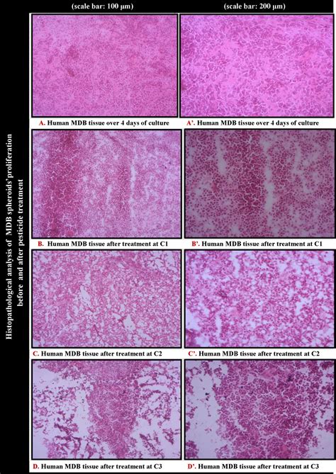 Shotgun Proteomic Based Approach With A Q Exactive Hybrid Quadrupole Orbitrap High Resolution