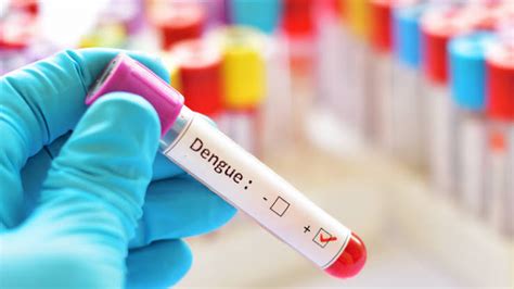 Minsa Implementa 49 Laboratorios Para El Diagnóstico De Dengue El Men
