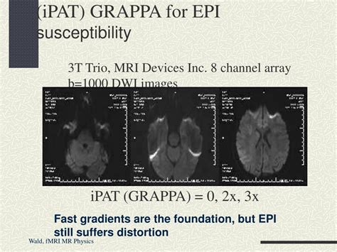 Ppt Mr Physics And Safety For Fmri Powerpoint Presentation Free