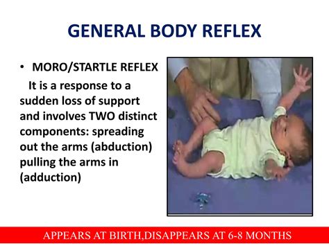 Assessment Of Newborn Reflexes Pptx