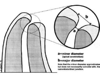 LENGTH DETERMINATION Ppt